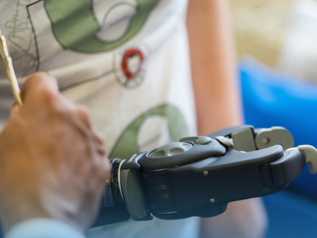 Программу протезирования от "Метинвеста" и Protez Hub проходят уже около 70 человек